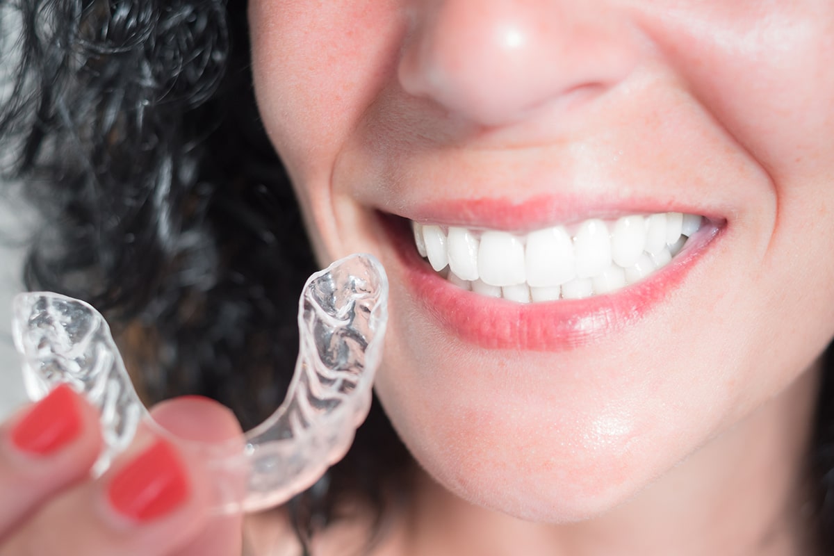 Invisalign Vs Braces Wilson Park Dental